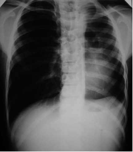 Racjonalne zasady wykorzystania badania radiologicznego oraz zasady ...