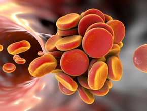 Biopsja aspiracyjna cienkoigłowa (BAC) a stosowanie leków ...