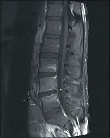 Wykorzystanie badań obrazowych w diagnostyce pacjentów z bólem krzyża - strona 2 - Inne ...